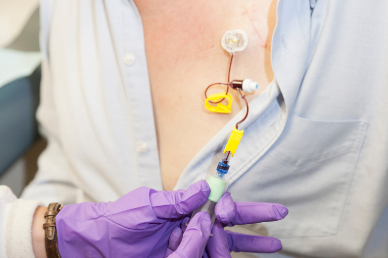 7 things to do before starting chemotherapy | LBBC